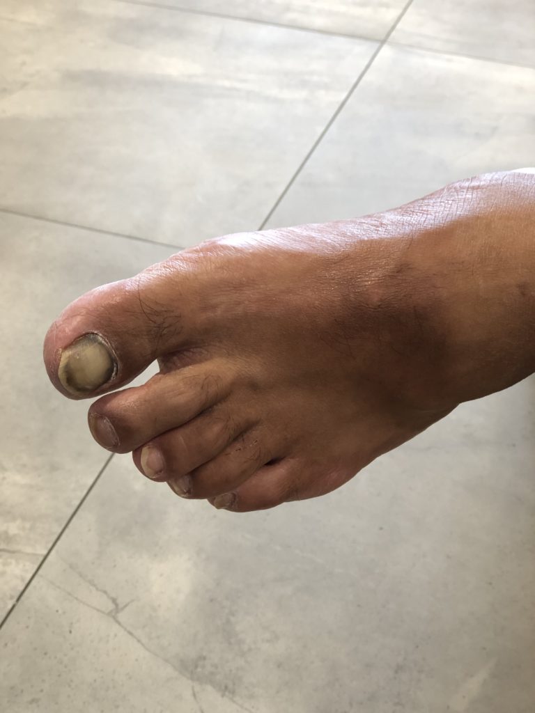 Remedy | Nail Rot - Vim & Co